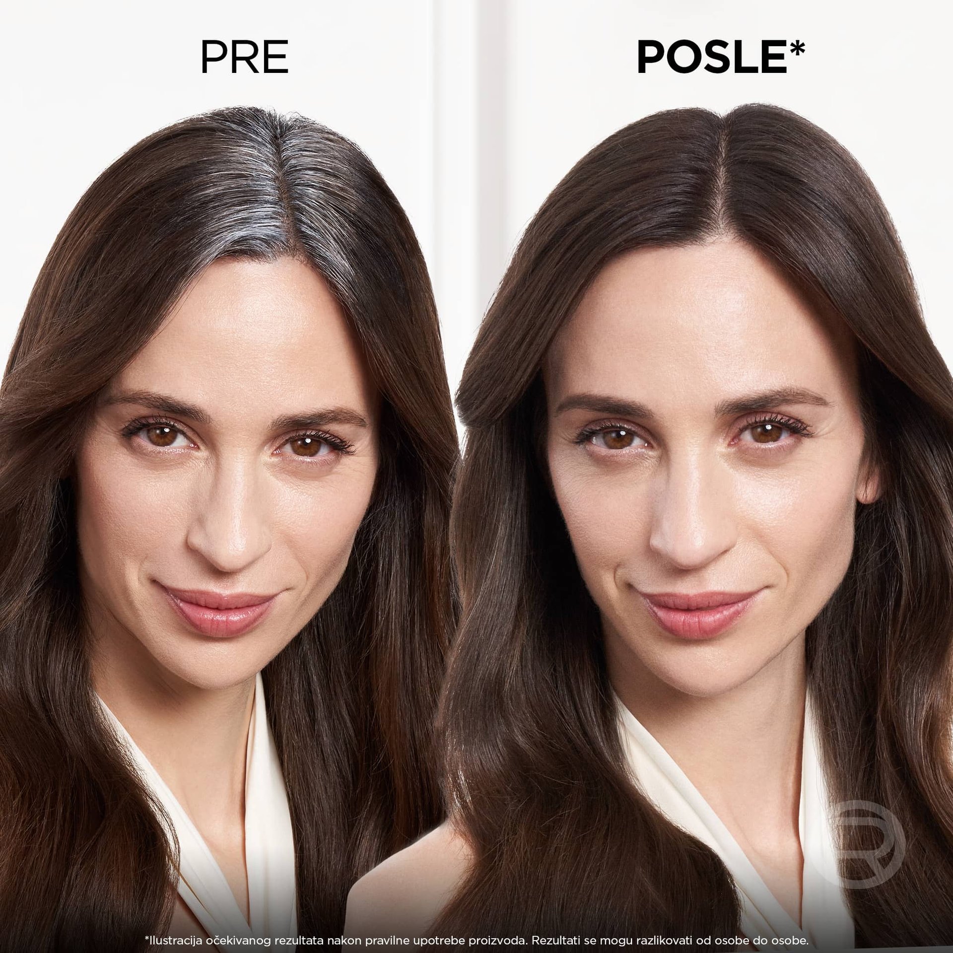 Magic Retouch 3 brown sprej za prikrivanje izrastka. | L'Oréal Paris